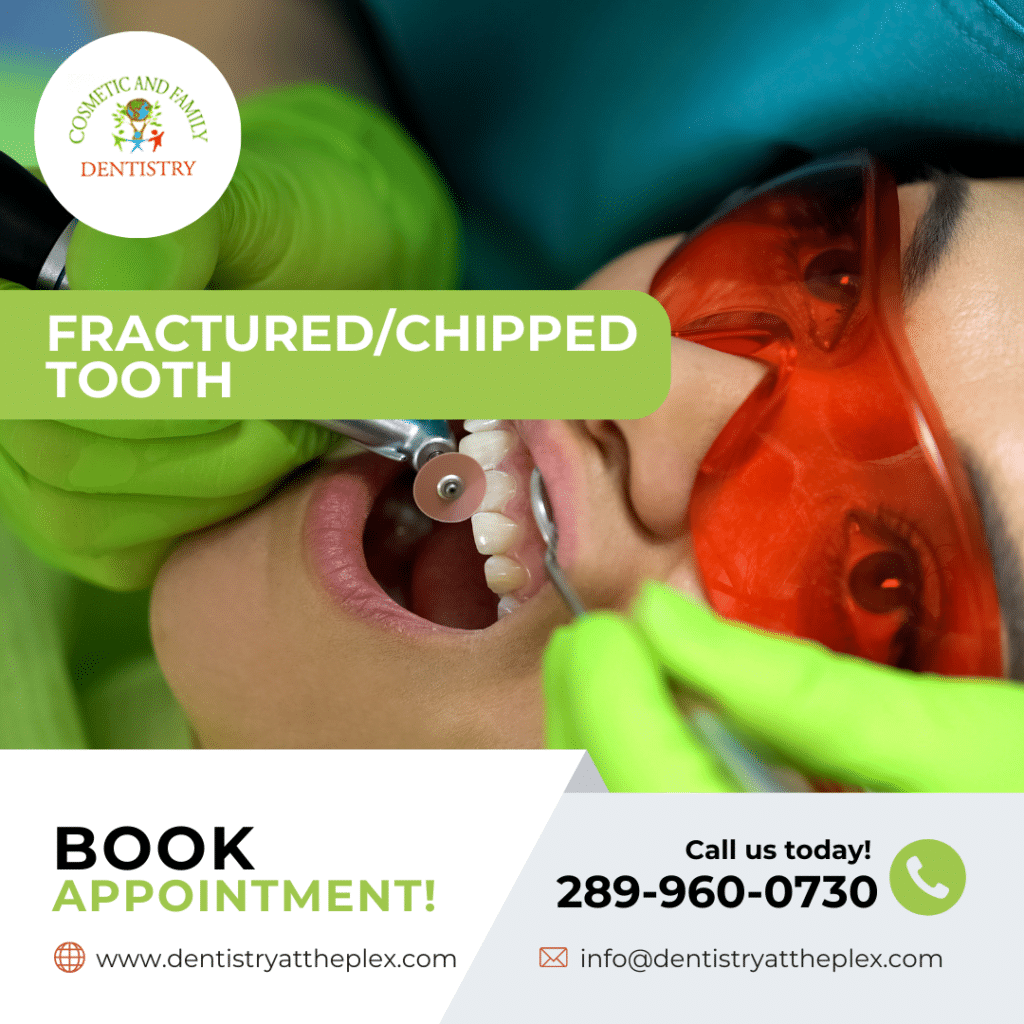Fractured/Chipped tooth - Caledonia Medical Plex